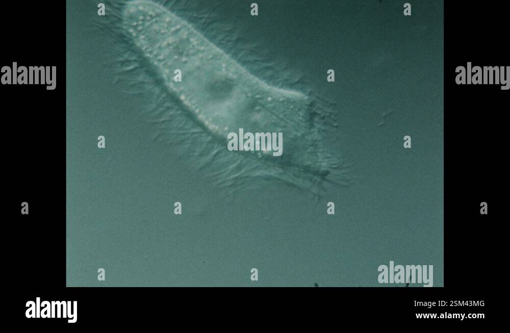 1980s: Paramecium swims through water. Cilia move dust and mucus ...