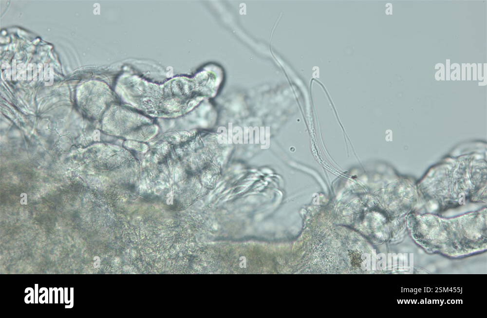Larvae of parasitic worm Progonus muelleri under microscope, Cercaria ...