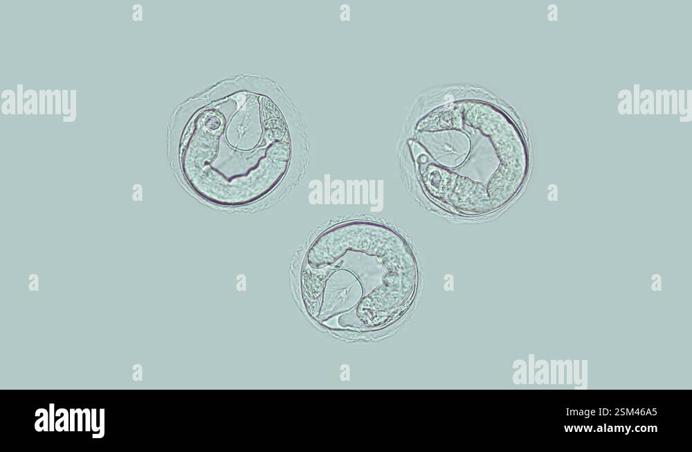 Cyst or capsule of parasitic worm cercaria Lecithaster salmonis under ...