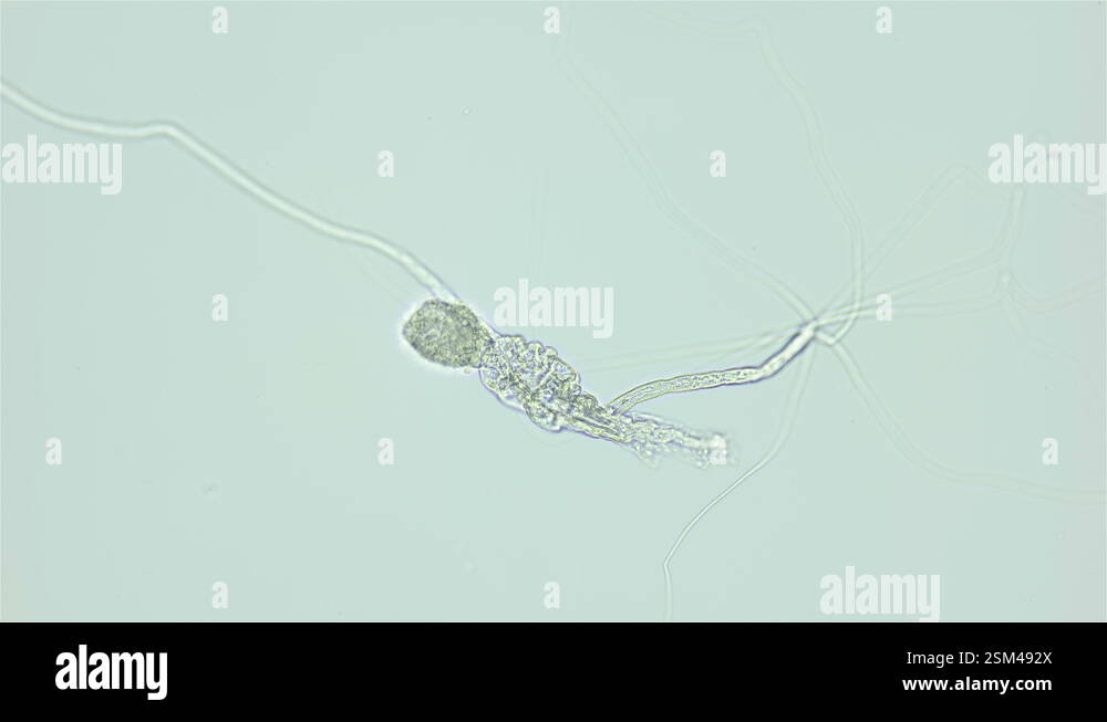 Larva of parasitic worm Progonus muelleri under microscope, Cercaria ...