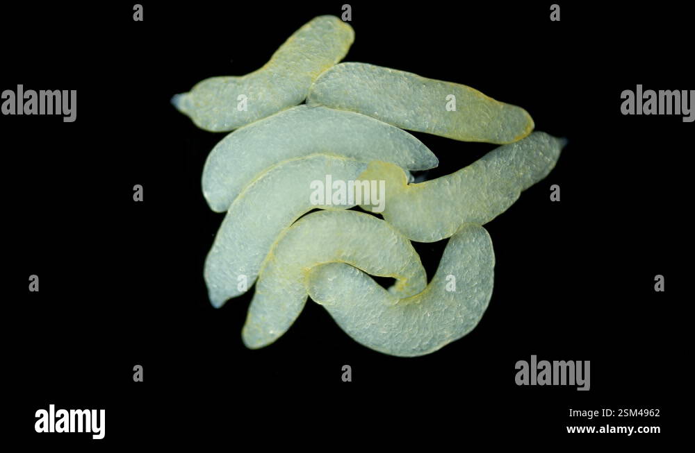 Sporocysts stage of parasitic worm Podocotyle sp. under a microscope Stock Video Footage - Alamy