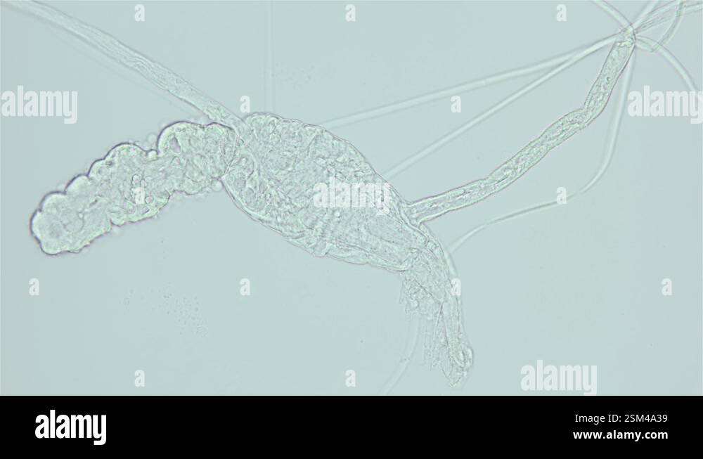 Larva of parasitic worm Progonus muelleri under microscope, Cercaria ...