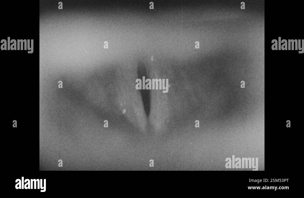 1950s: Illustrated graph, arrow appears. Slow motion of larynx ...
