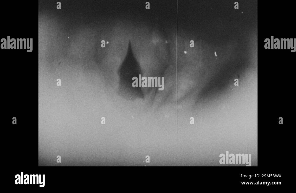 1950s: Slow motion of larynx opening and closing Stock Video Footage ...