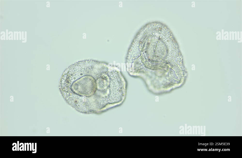 Larvae sea urchin Strongylocentrotus pallidus under microscope ...