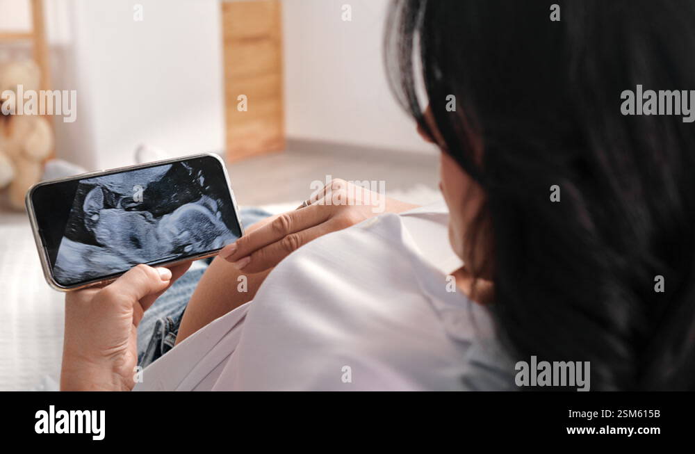 Pregnant woman with belly looking digital x ray baby roentgen scan ...