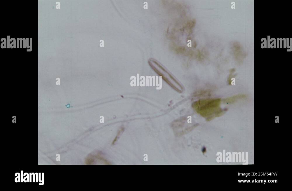 1960s: Single cell of Grass of the Sea. Views of microscopic underwater ...