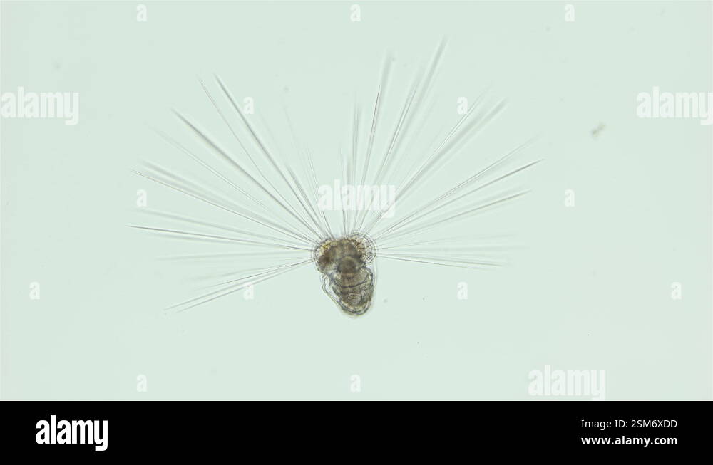 Larva mitraria of worm Polychaeta, of the Oweniidae family under ...