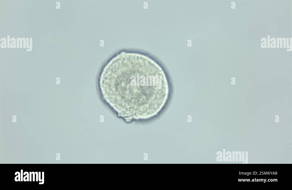 Larva sea urchin Strongylocentrotus pallidus under microscope, phylum ...