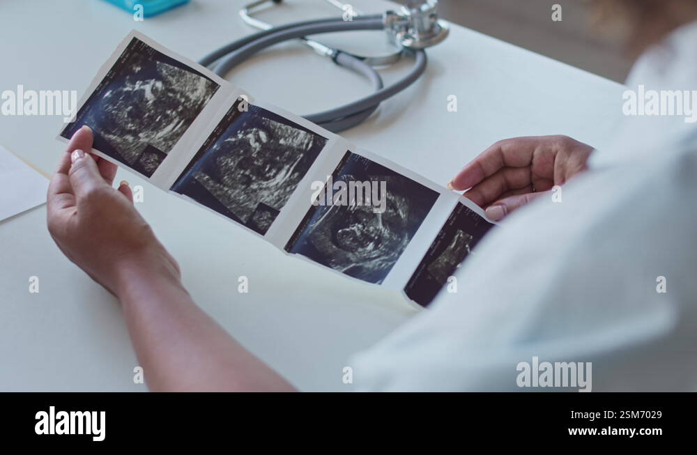 Gynecologist Discussing Baby Ultrasound with Future Mother in Clinic ...