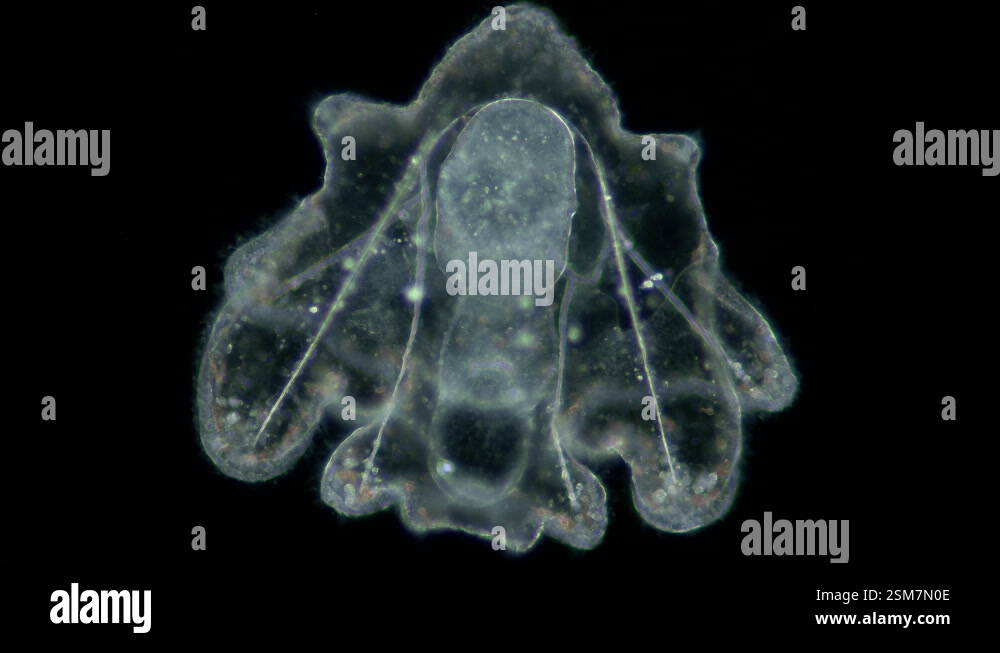 Larva sea urchin Strongylocentrotus pallidus under microscope, phylum ...