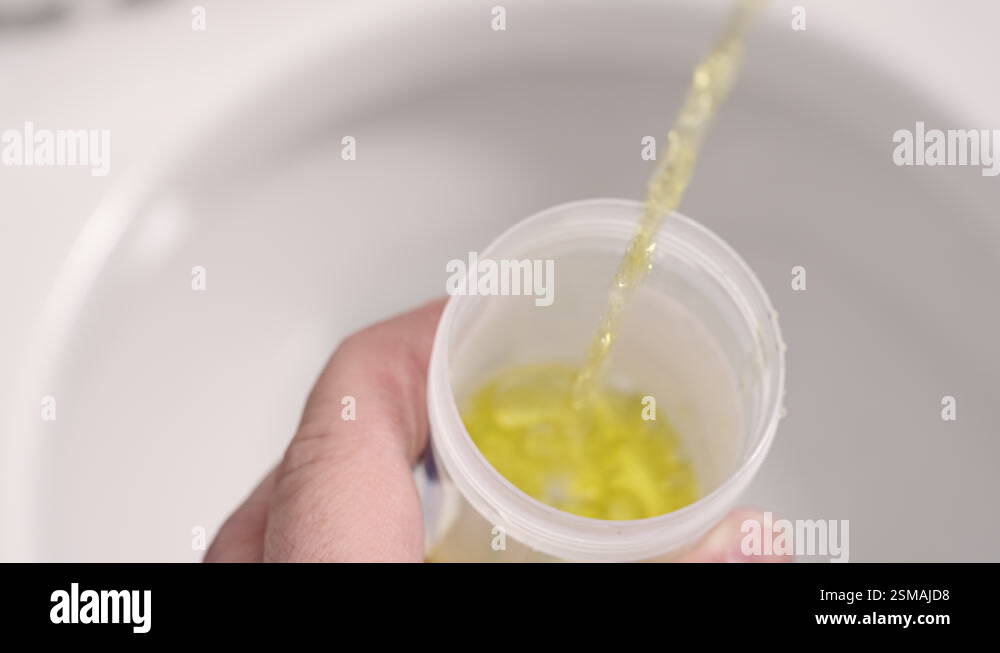 Providing a urine sample for doctor visit or urinalysis drug test Stock ...
