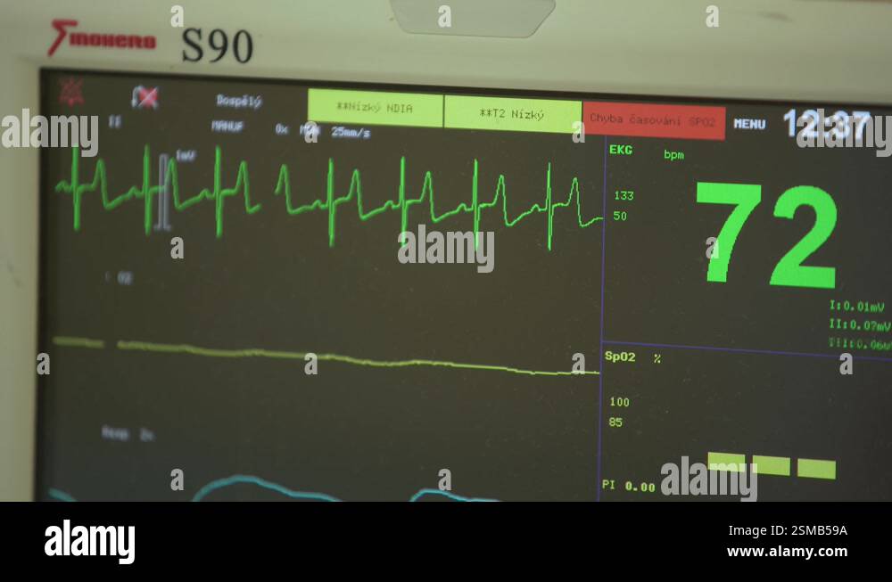 Heart monitor measuring vital signs. Low pressure and heart rate Stock ...