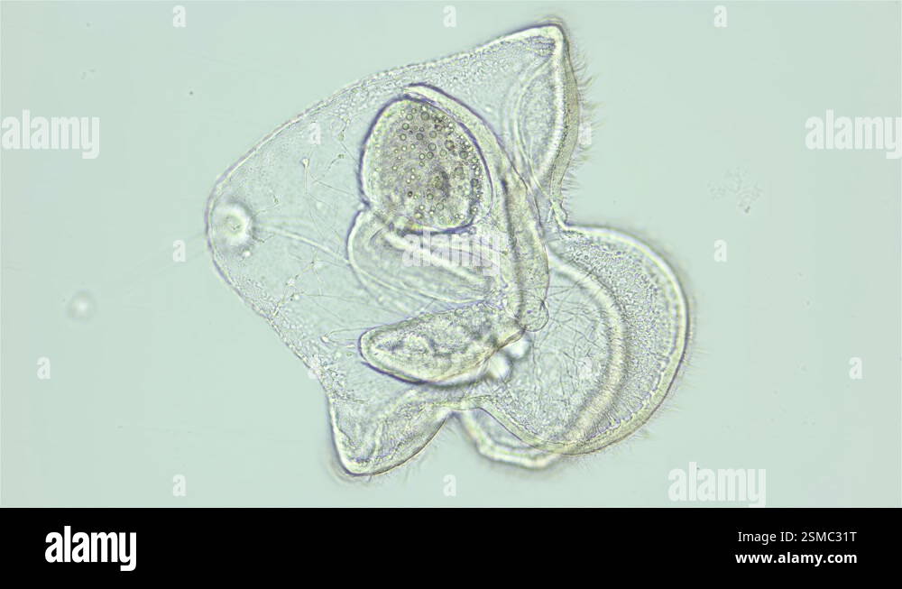 Pilidium larva of worm Heteronemertea under microscope, genus ...