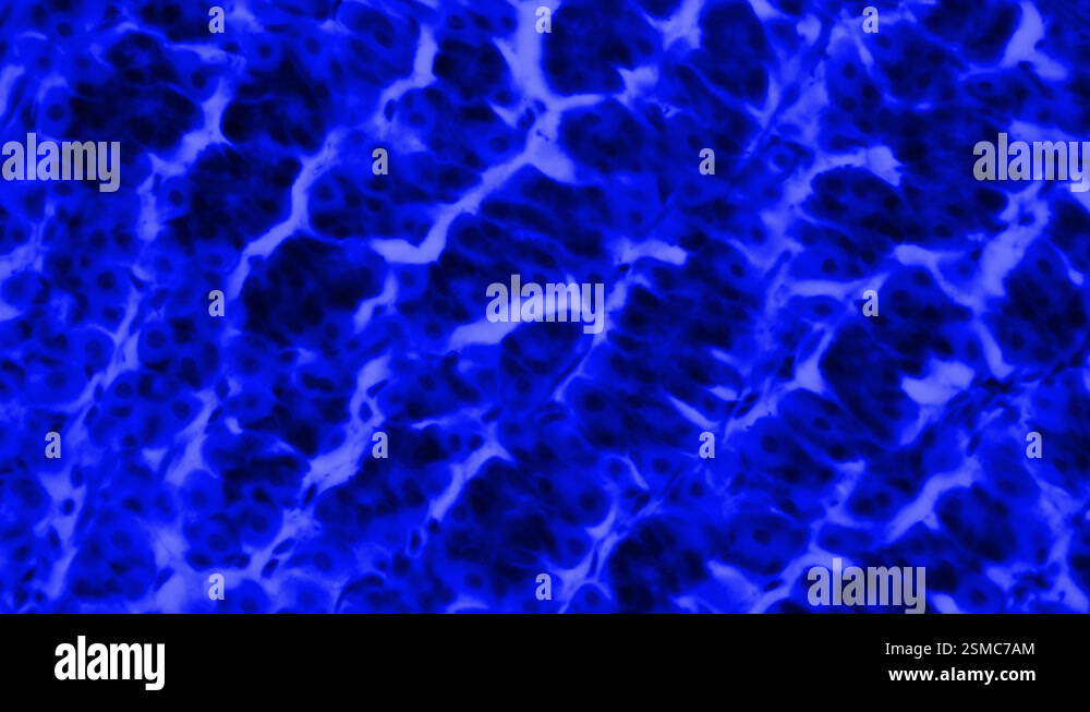 Thin section of human stomach with contrast under a microscope ...