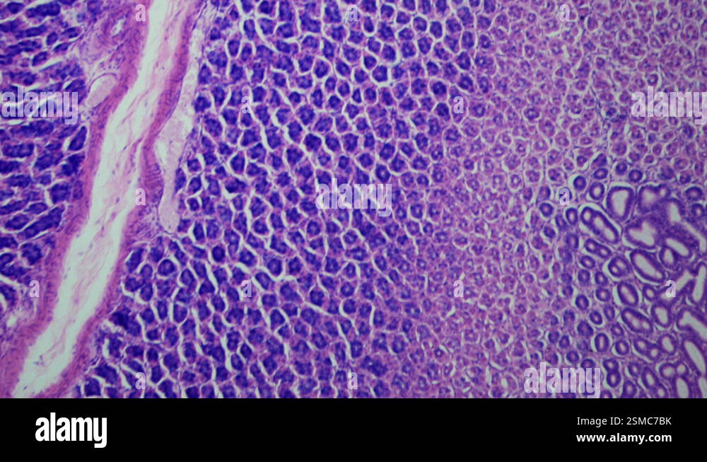 Thin section of human stomach with contrast under a microscope ...