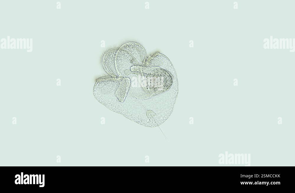 Pilidium larva of worm Heteronemertea under microscope, genus ...