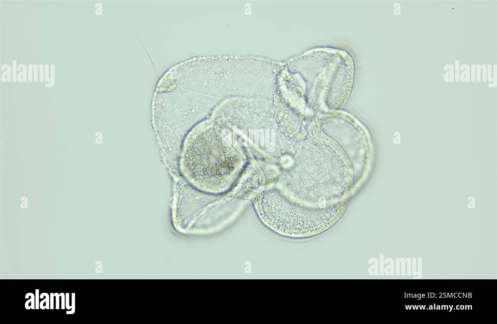 Pilidium larva of worm Heteronemertea under microscope, genus ...