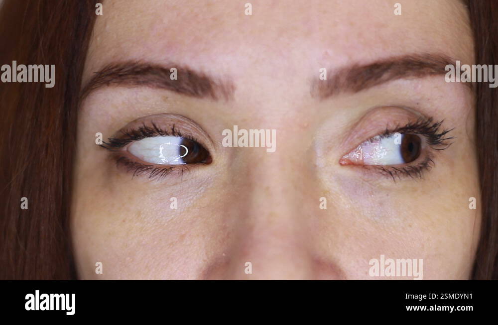 Eye fear Stock Videos & Footage - HD and 4K Video Clips - Alamy
