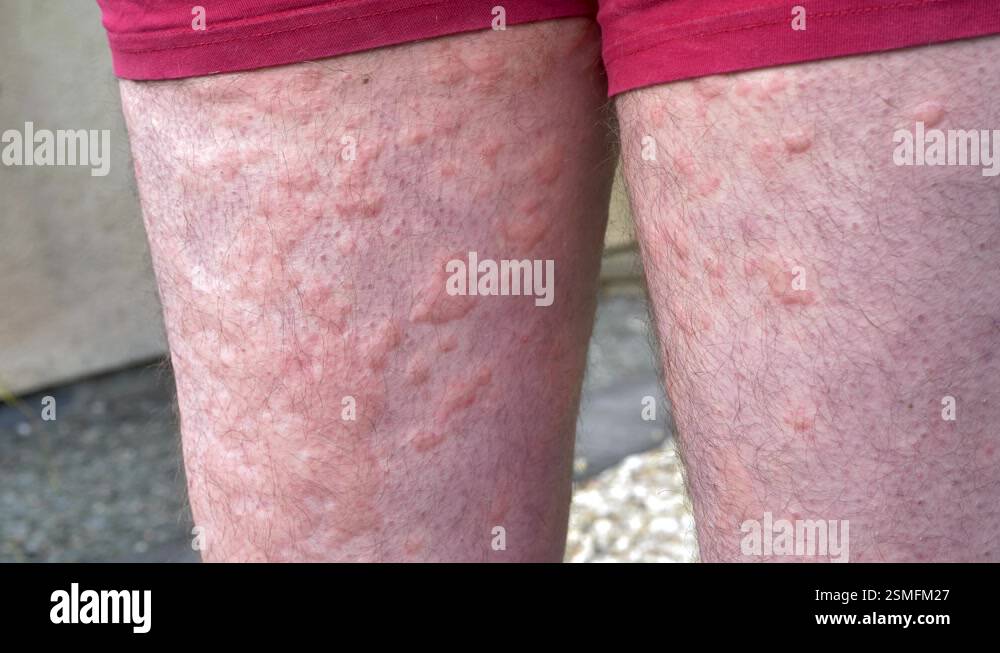 Healthcareissue Stock Videos & Footage - HD and 4K Video Clips - Alamy