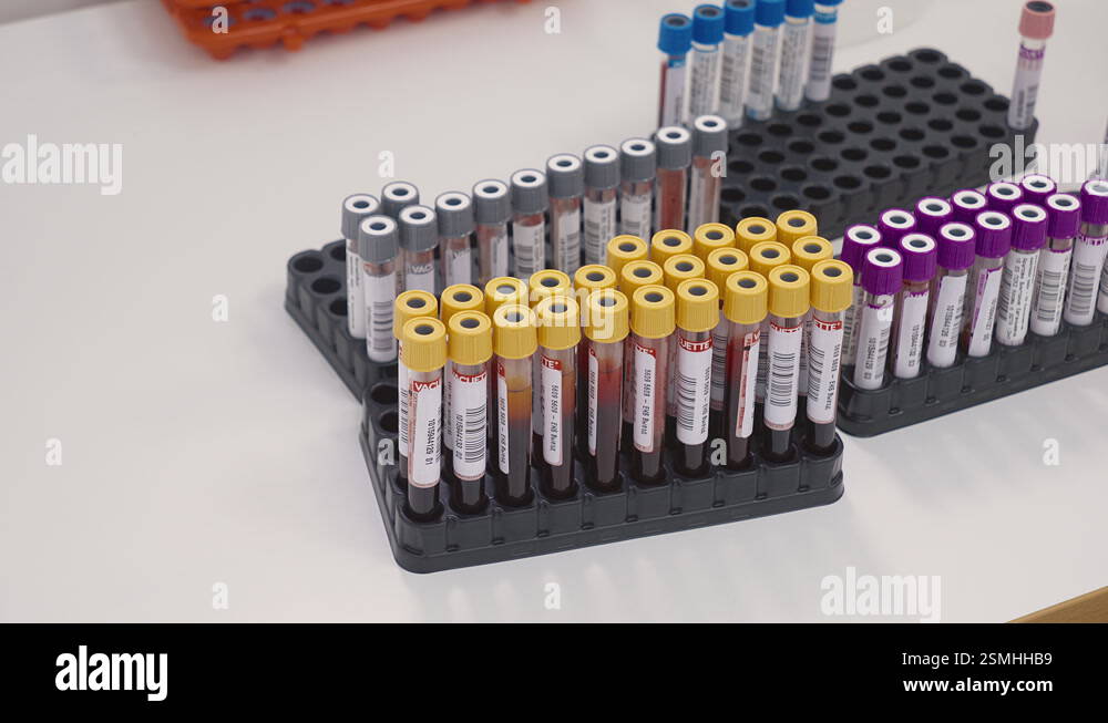 Laboratory medical test tubes Stock Videos & Footage - HD and 4K Video ...