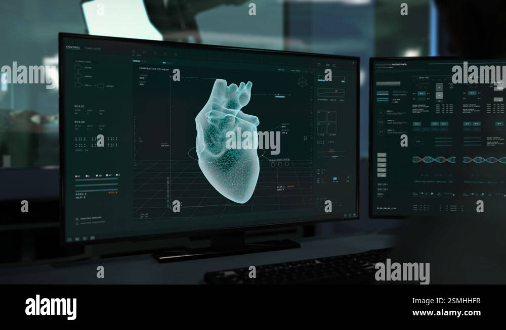 3d Printer Creates Realistic Model Of Heart Internal Organ From ...