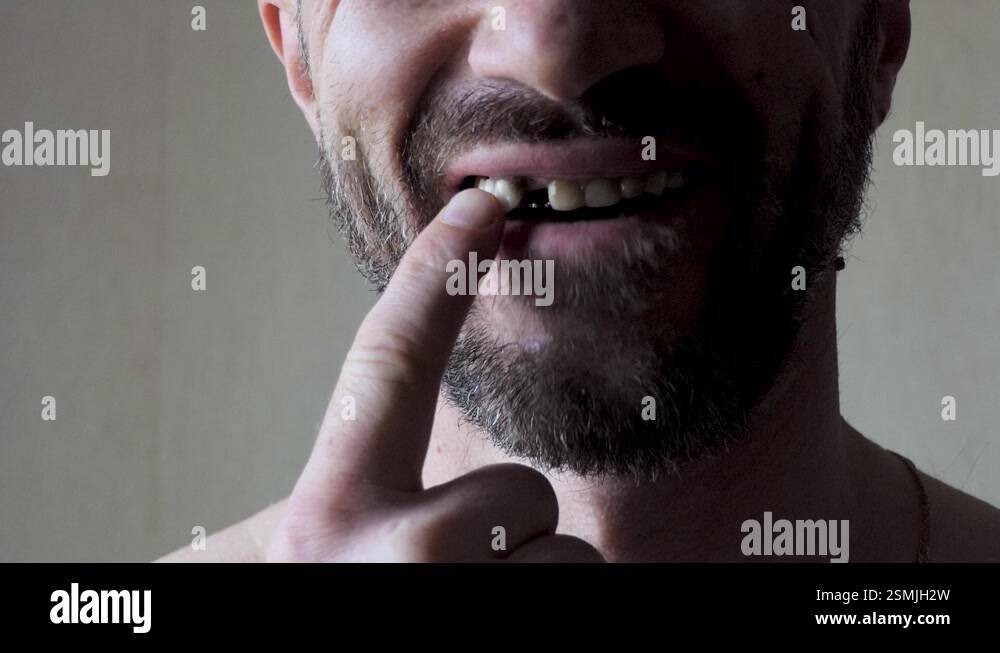 Tooth missing man Stock Videos & Footage - HD and 4K Video Clips - Alamy
