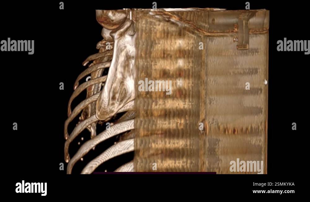 High-Resolution Body CT Scan with Interactive 3D Reconstruction and ...