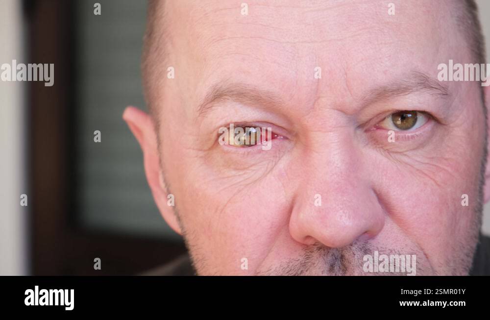 Pressure injury Stock Videos & Footage - HD and 4K Video Clips - Alamy