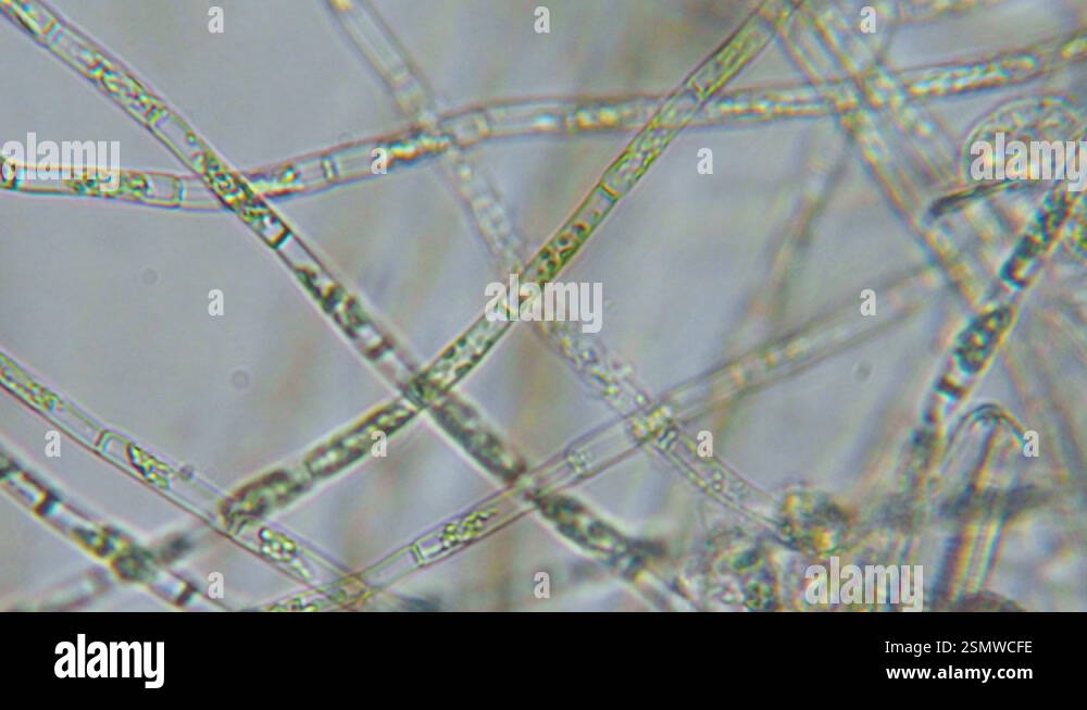 Green Algae Water Plant Under Microscope. Chloroplast Under Microscope ...