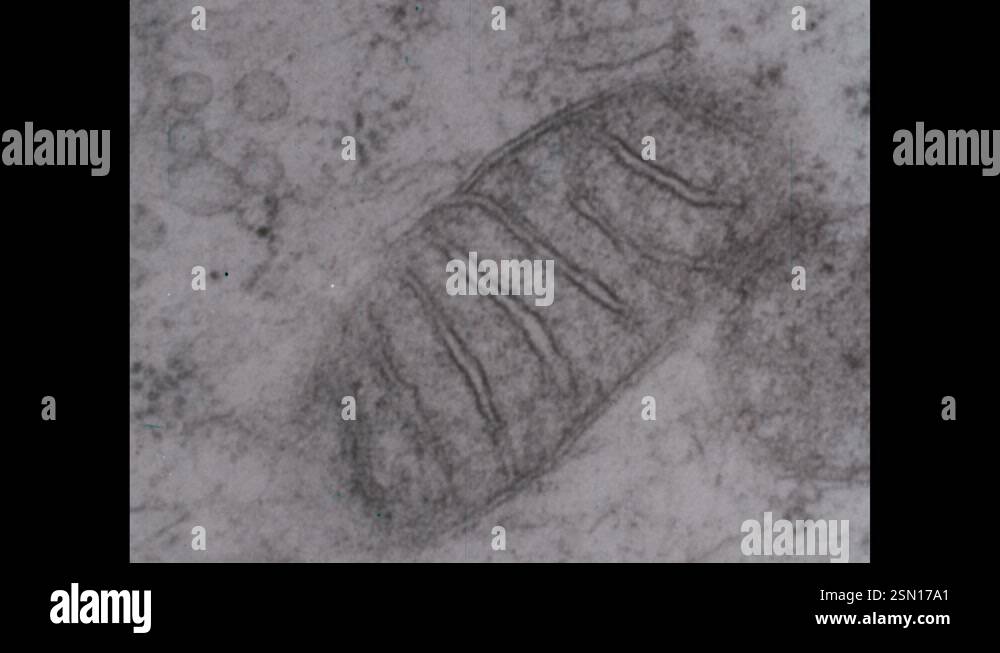1960s: Chloroplast of cell magnified under electron microscope Stock ...