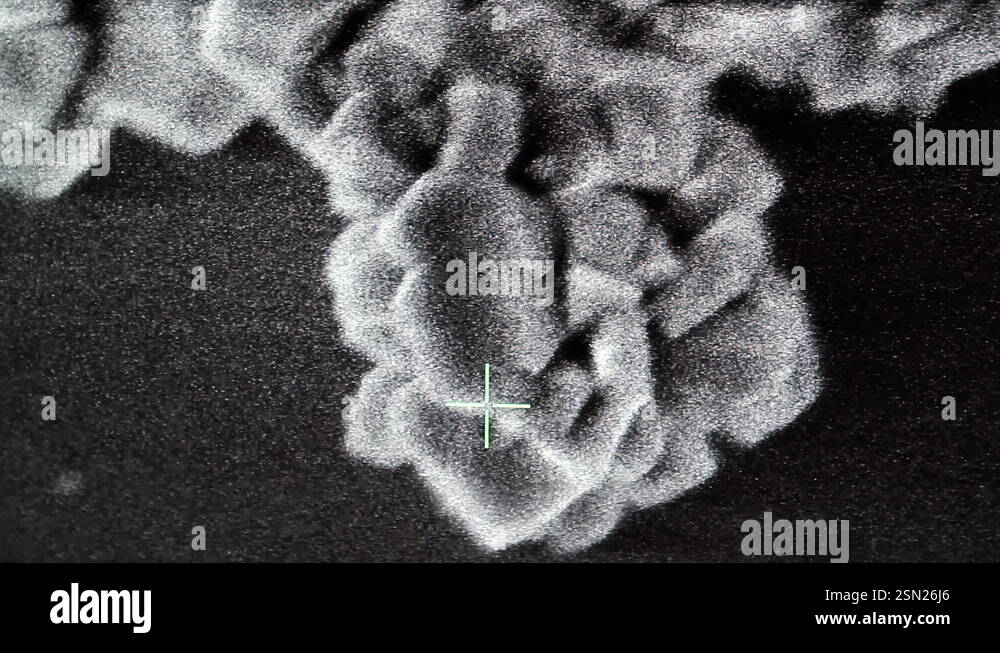 Scanning Electron Microscope (SEM) Image of a Magnified Sample in the ...