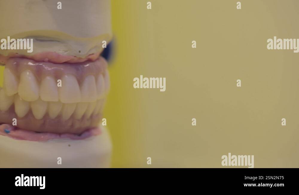 Dental prosthetic with upper and lower sets of teeth being adjusted on ...