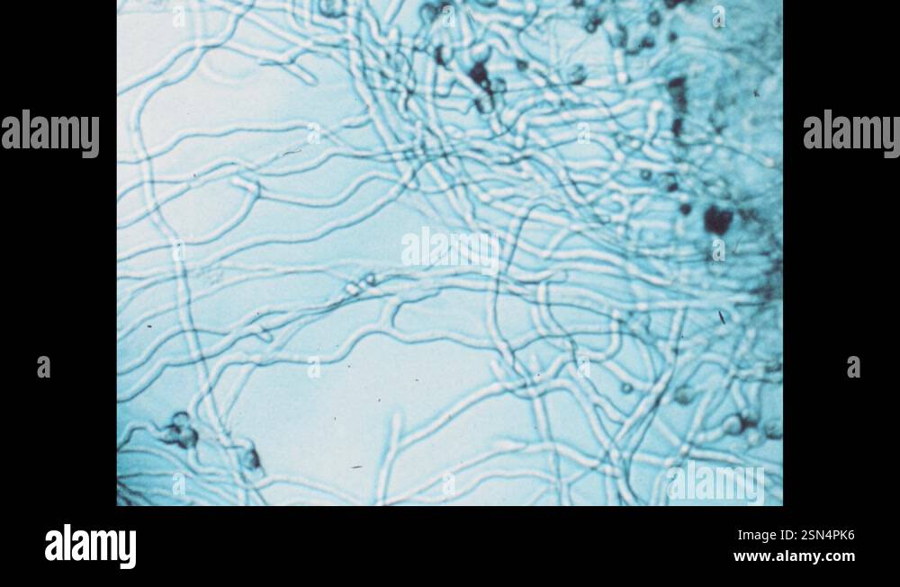 1960s: Microscopic view of filaments growing out of spores. Microscopic ...