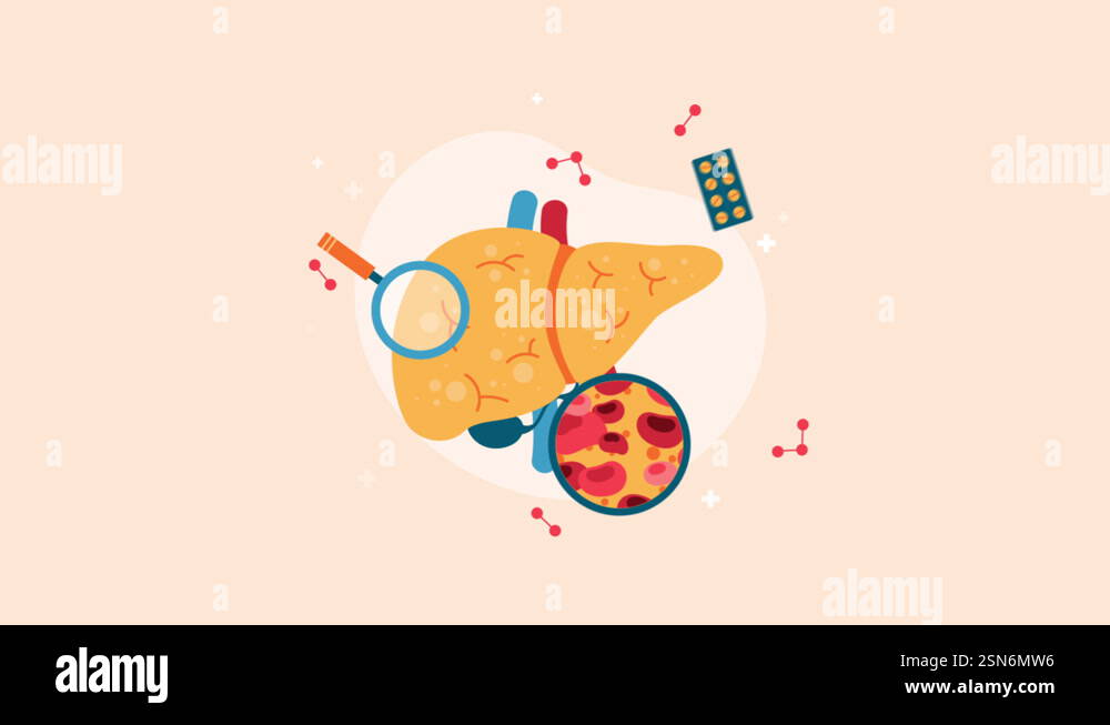 Stages Of Liver Disease Animation Background Stock Video Footage - Alamy
