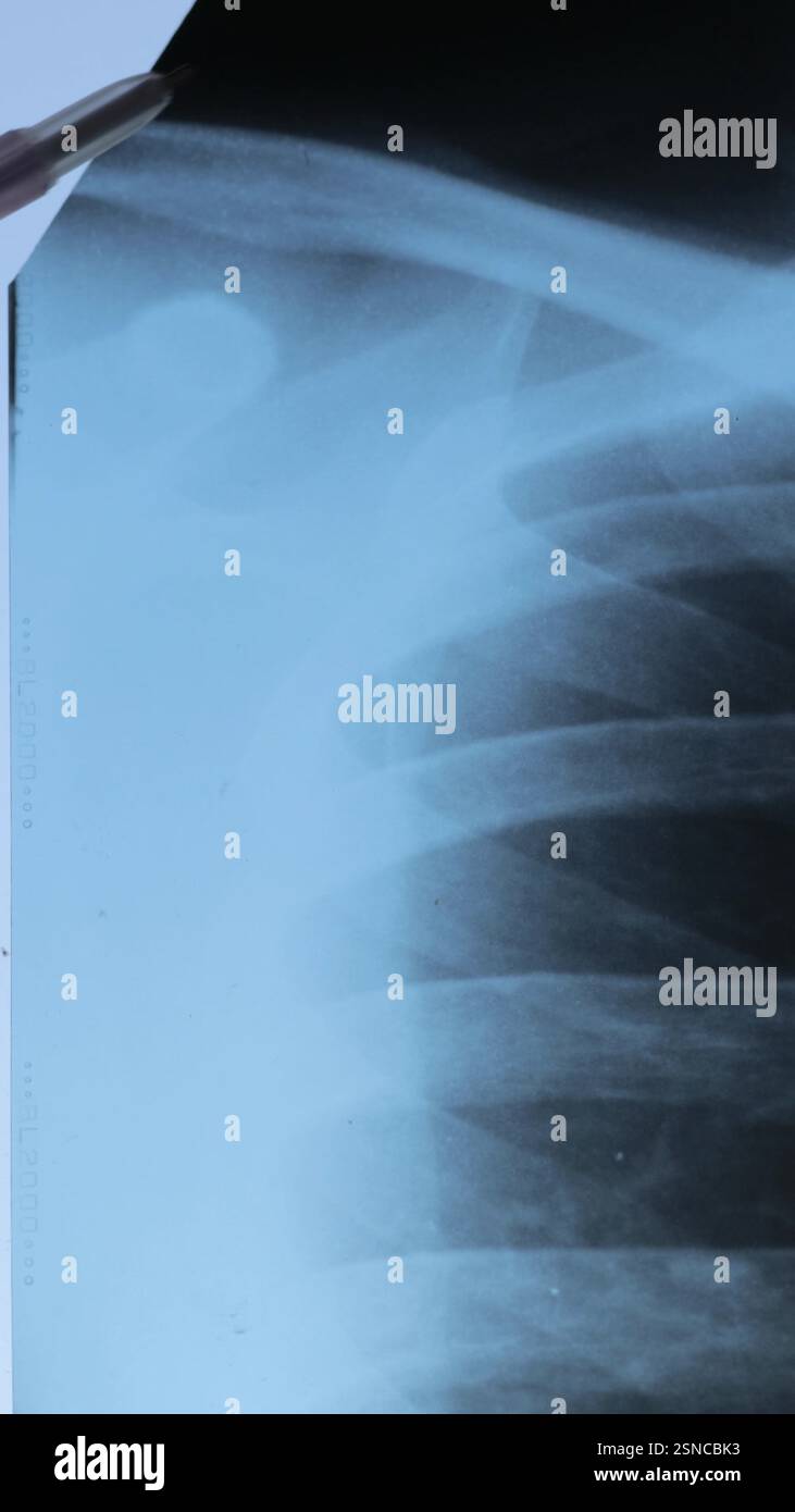 Vertical footage of Doctor examining X-ray scan Stock Video Footage - Alamy