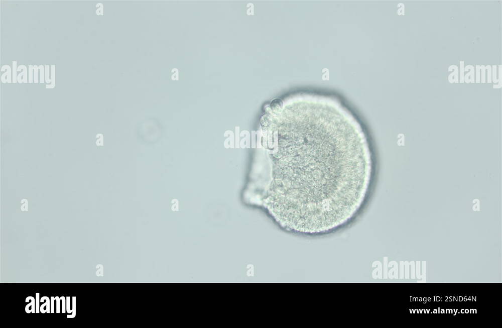 Larva sea urchin Strongylocentrotus pallidus under microscope ...