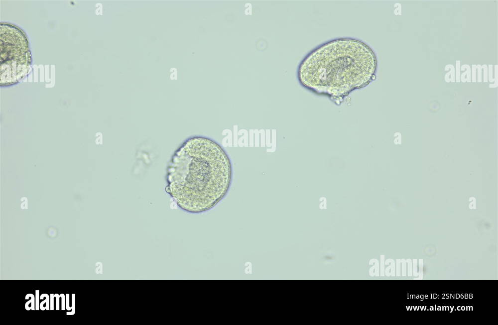 Larvae sea urchin Strongylocentrotus pallidus under microscope ...