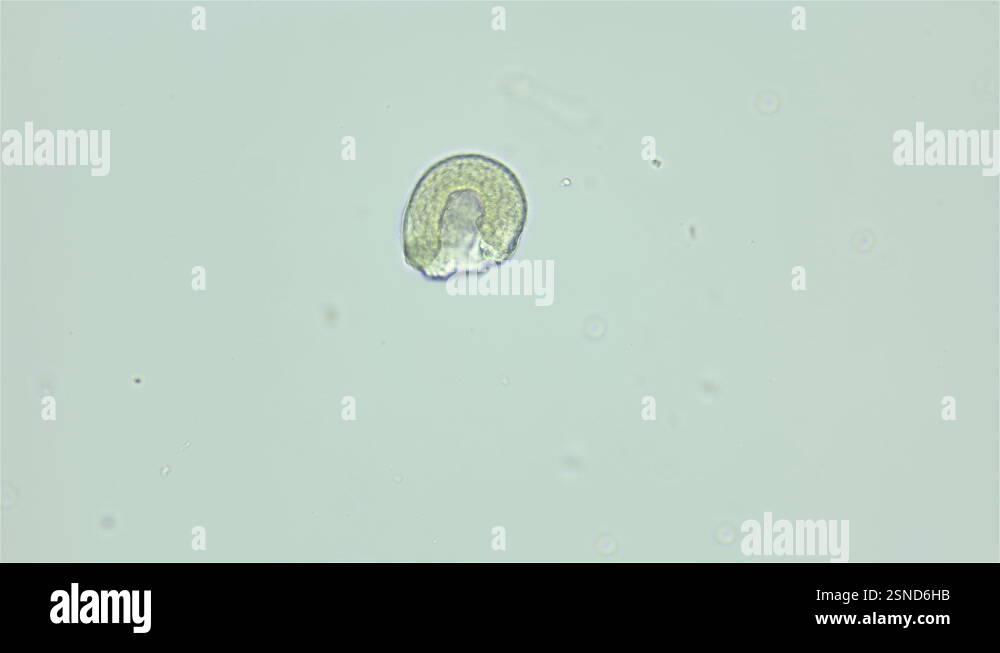 Larva sea urchin Strongylocentrotus pallidus under microscope ...