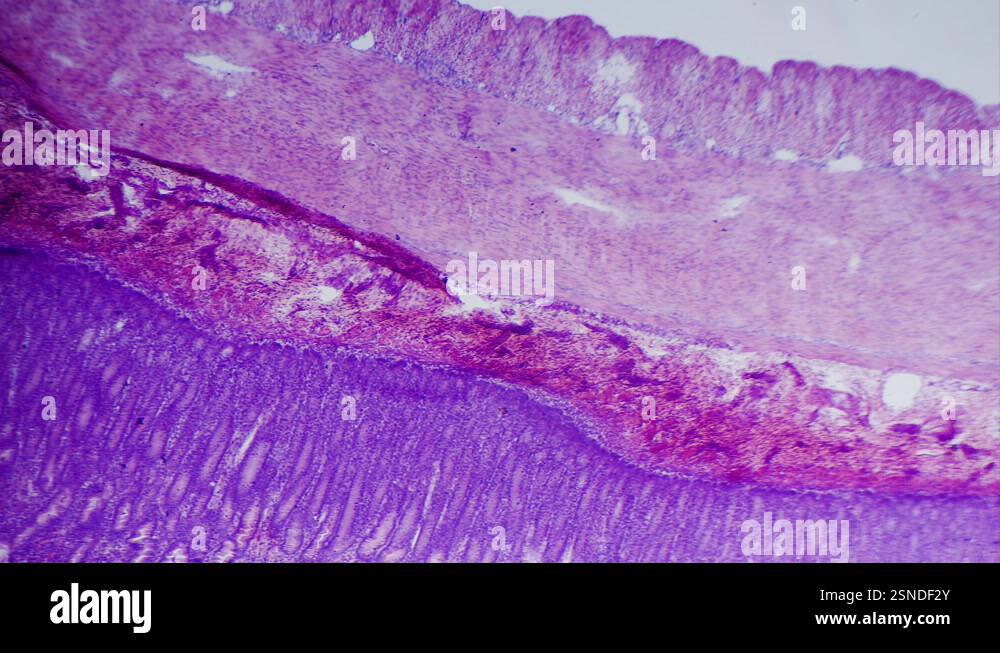 large intestine transverse section Stock Video Footage - Alamy
