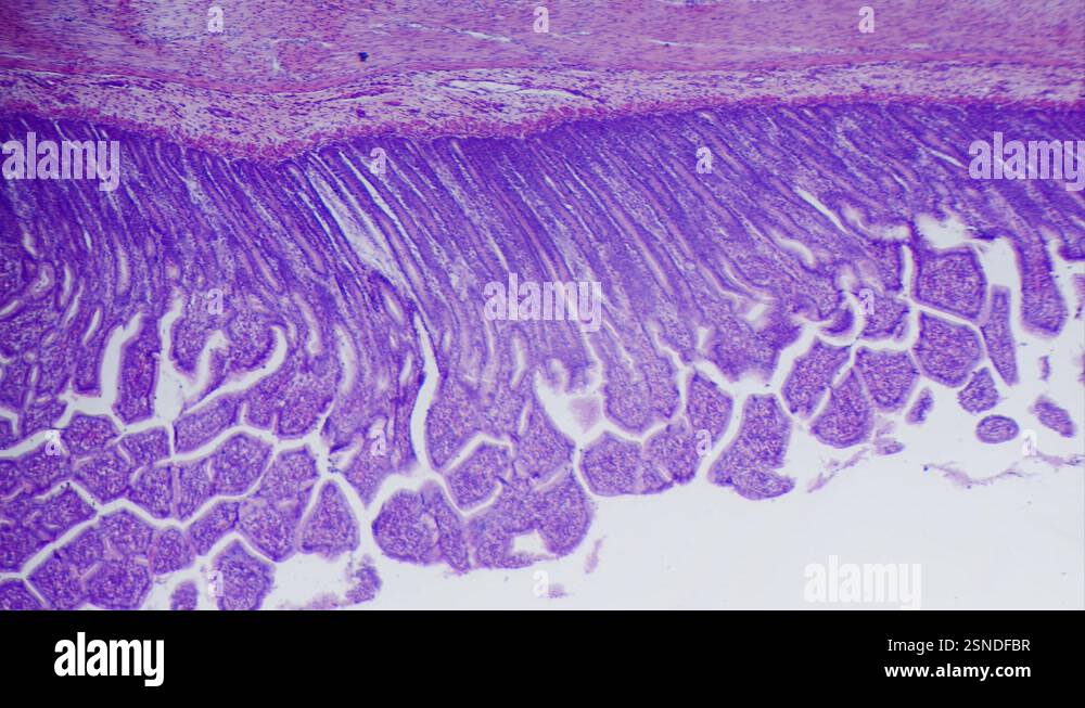 large intestine transverse section Stock Video Footage - Alamy