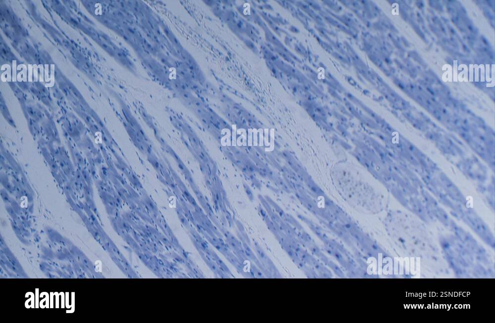 Cardiac muscle contraction Stock Videos & Footage - HD and 4K Video ...