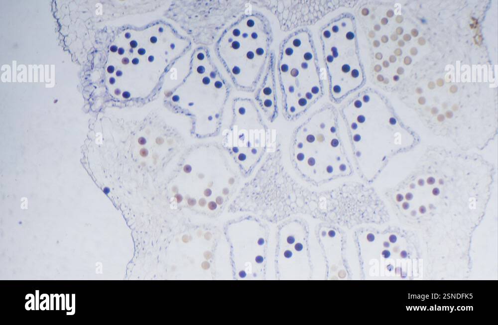 Stained stem of monocotyledon transverse section under microscope ...