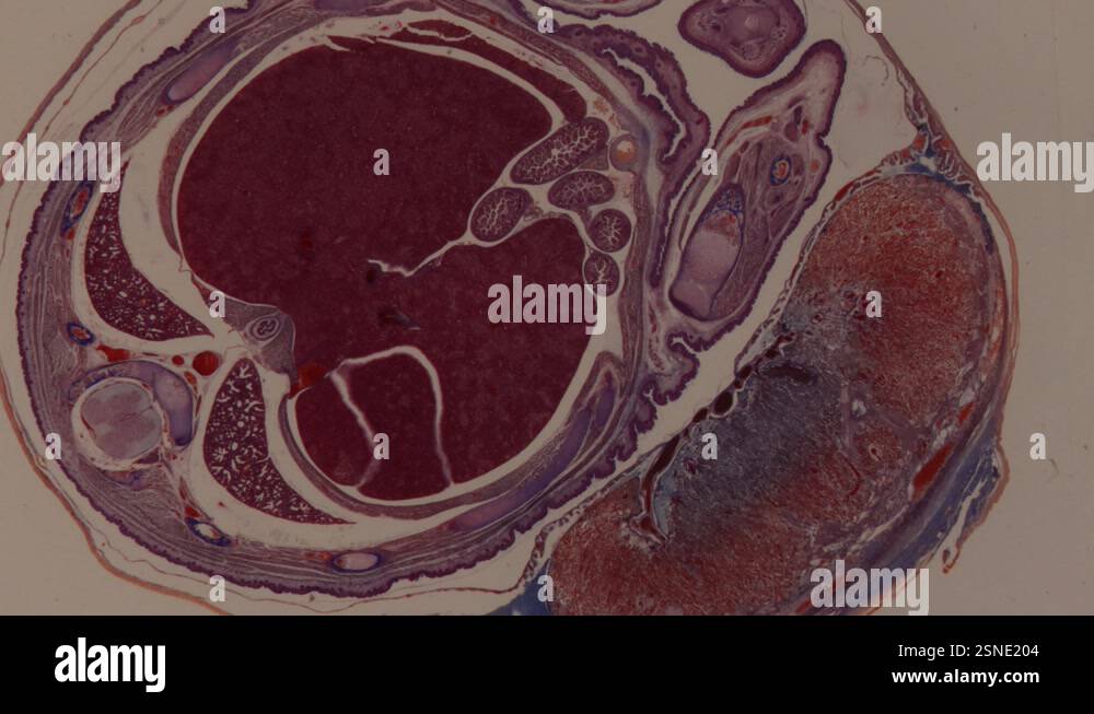 Uterus Stock Videos & Footage - HD and 4K Video Clips - Alamy