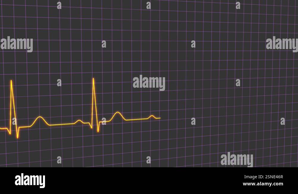The normal heart Stock Videos & Footage - HD and 4K Video Clips - Alamy