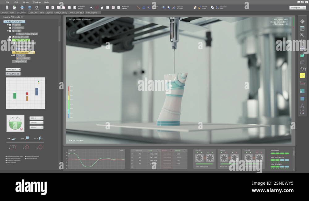 Development of the fully functional robot arm prosthesis for amputee ...