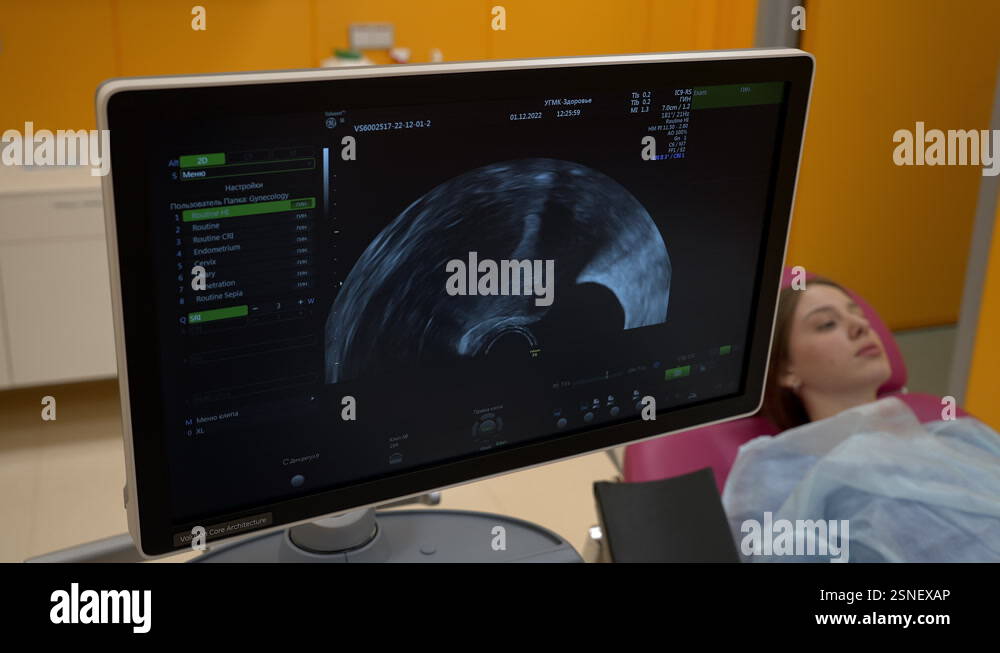Monitoring pregnancy female patient ultrasound Stock Videos & Footage ...