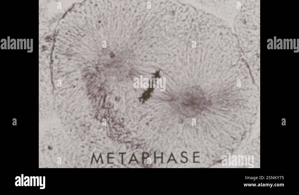 1960s: Microscopic view of chromosomes in cell during metaphase ...