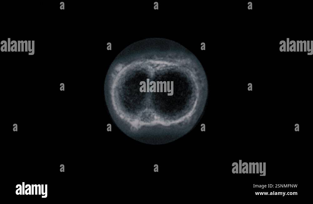 1960s: Microscopic view of the first cell division of the ovum. Diagram ...