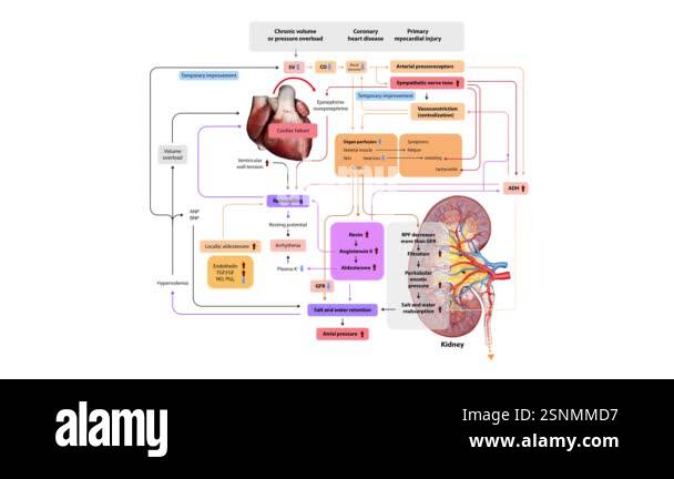 pathophysiology of heart failure, detailing mechanisms like volume ...